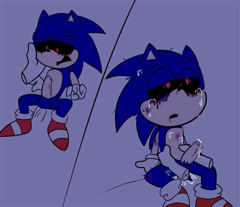 Rule 34 Anal Anal Sex Ankifun Balls Beaten Beaten Up Black Eye