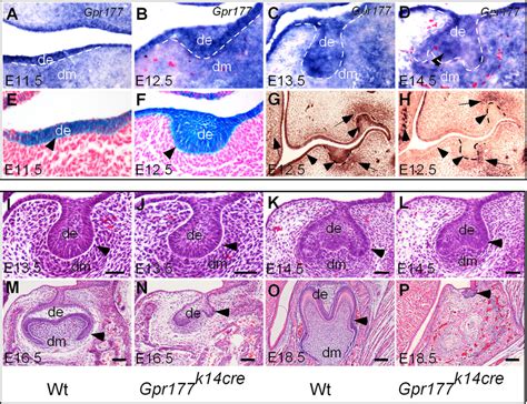 Gpr177 Is Required For Mouse Tooth Morphogenesis Ad In Situ