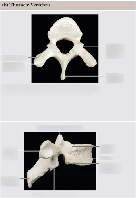 Thoracic Vertebra Diagram Quizlet