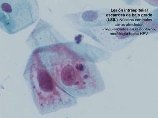 Tema 5 Citología Ginecológica Pptx