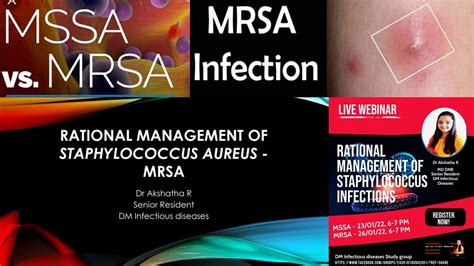 Staph Infection Mssa At Bernadette Williams Blog
