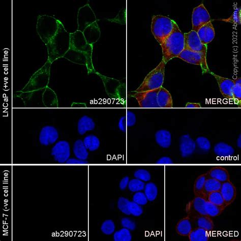 Anti Steap1 Antibody [epr26044 70] 20 Ul Size Ab290723 Abcam