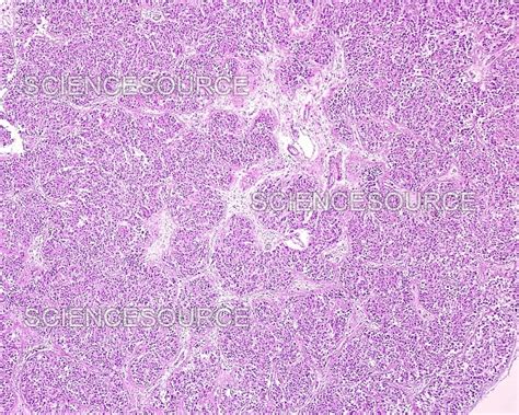 Pineal Gland Lobulation Light Microgr Stock Image Science Source Images