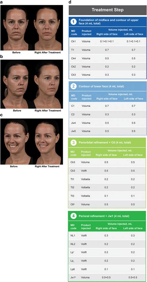 Md Codes™ A Methodological Approach To Facial Aesthetic Treatment With