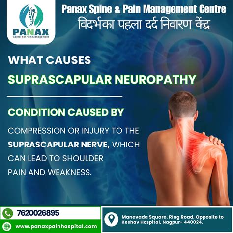 Panax What Causes Suprascapular Neuropathy👨‍⚕️ Suprascapular