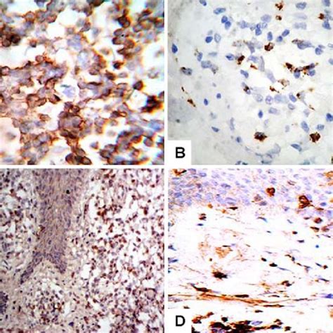 The Expression Pattern Of Cd3 Cells In The Positive Control Normal Download Scientific