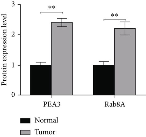 Pea3 Was Regarded As A Transcriptional Factor Of Rab8a And Positively Download Scientific