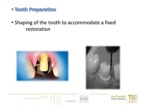 Principles Of Tooth Prep Ppt 20 21taifpdf