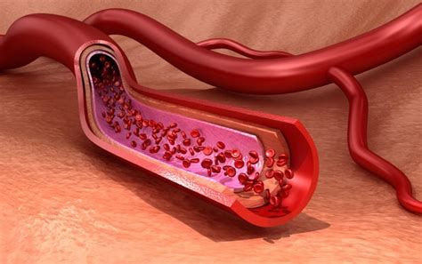 Defibrotide Shows Broad Promise In Managing Endothelial Injury Across