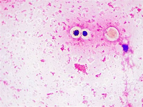 Gram Stain Itm Labhub