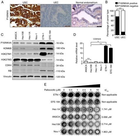 Targeting P16ink4a In Uterine Serous Carcinoma Through Inhibition Of