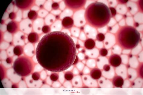 The Visual Field Defects In Glaucoma Acibadem Health Point Acibadem Hospitals Acibadem