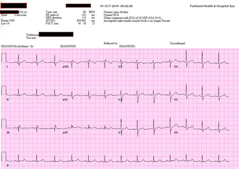 Ekg Practice Strips Printable Printable Free Templates