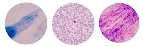 Free White Blood Cell Labeled Diagra Photos And Pictures Freeimages