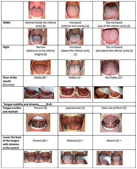 The Structures Initially Described Were Related To The Velopharynx