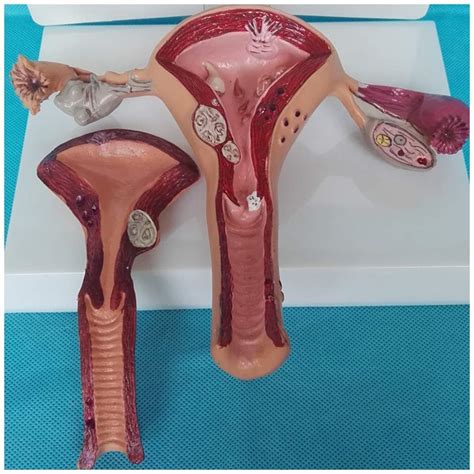 Buy Yz Yuan Assembly Educational Model Uterus Model Uterus Ovary