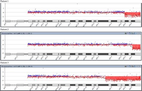Acgh Profile Indicating The Segment Deletions On Chromosome 13q
