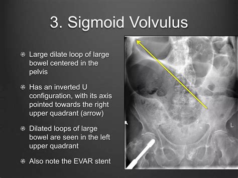 Approach To Pfa Interpretation Pptx