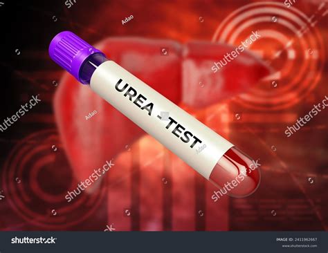 Blood Sample Urea Test Examination Diagnosing Stock Illustration