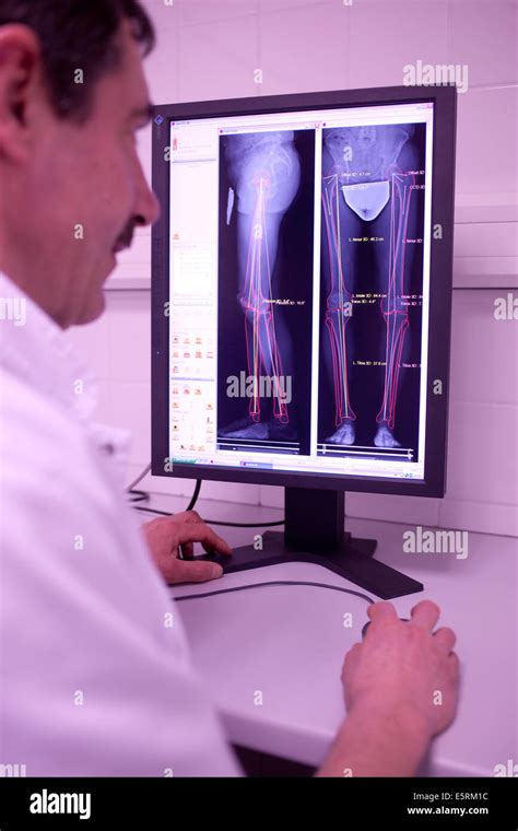 Eos Biplanar X Ray Scanner This 2d And 3d Digital X Ray Imaging