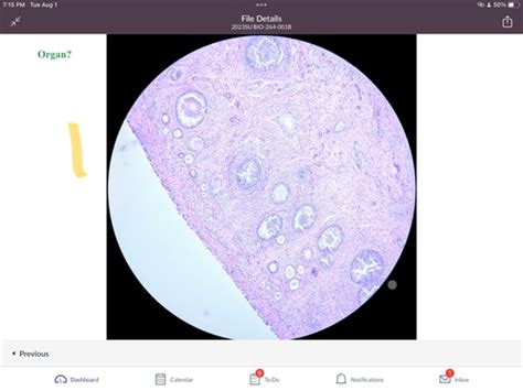 Female Reproductive Histology Flashcards Quizlet