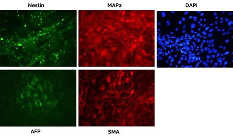 Ipsc Reprogramming Cocktail Ubrigene