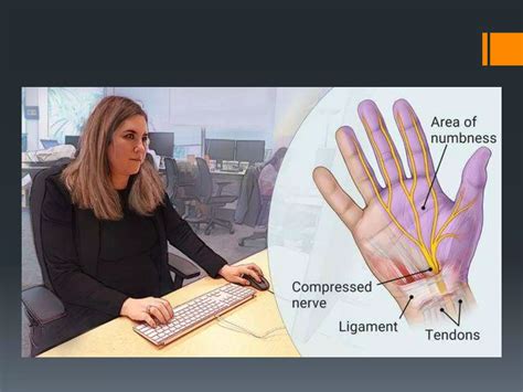Common Upper And Lower Extrimity Disorders Pptx