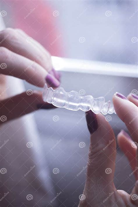 Clear Dental Teeth Retainers Stock Image Image Of Braces