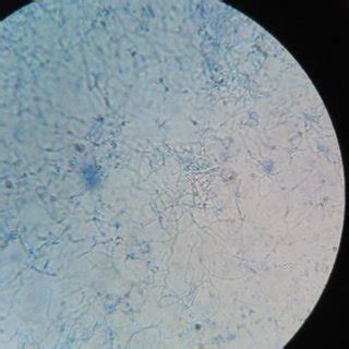 Streptomyces Isolate Folded Aerial Mycelia Download Scientific Diagram