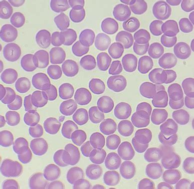 Eritrocitos Patología Clínica Veterinaria