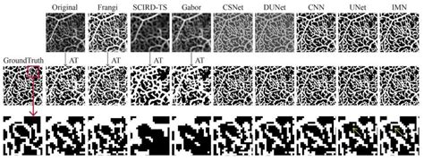 Shows The Segmentation Results Of An Example With Different Methods Download Scientific