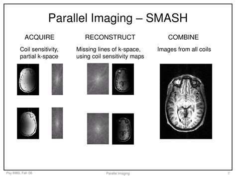 Ppt Parallel Imaging Powerpoint Presentation Free Download Id1298946