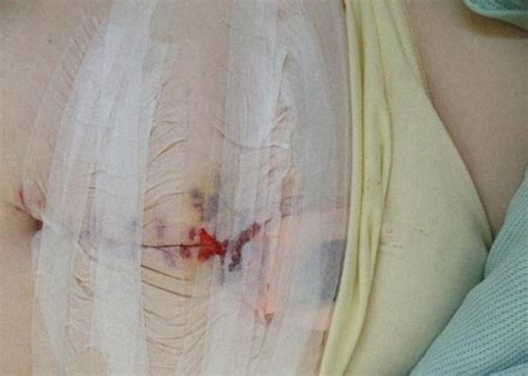 Clair Bartlet Biography Victim Of The Consequences Of Surgery