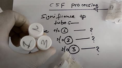 Adenosine Deaminase Test Introduction Principle Procedure Normal