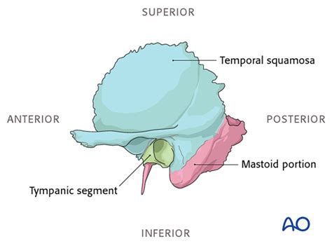Skull Base Fracture Temporal Bone