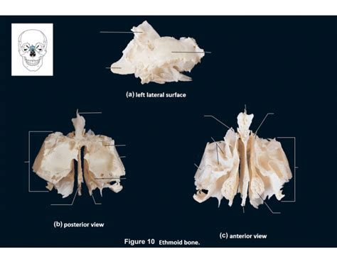 Ethmoid Bone Left Lateral Posterior Anterior — Printable Worksheet