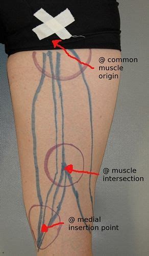 Massage Techniquesi So Need The Hamstring One Muscles Massage Muscle Massage