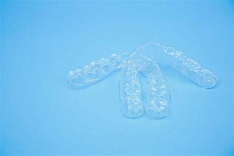 What Are Clear Braces Dragonfly Dental Of Port Charlotte Port