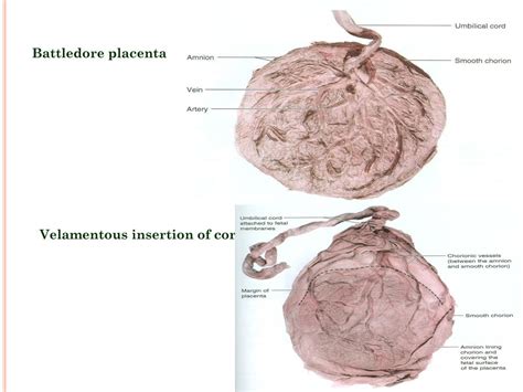 Ppt Fetal Membranes 2 Powerpoint Presentation Free Download Id6904457