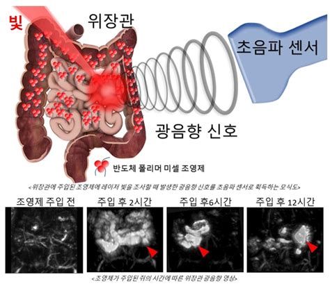 번개처럼 번쩍 고통 無빛으로 몸속 깊은 곳 들여다본다