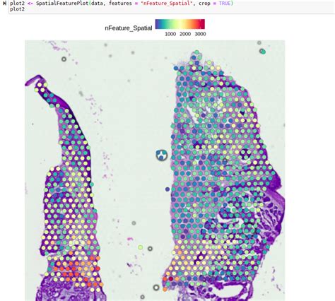 Cropping Issue With Spatialfeatureplot · Issue 2772 · Satijalabseurat · Github