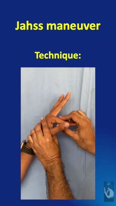 Shorts 127 The Jahss Maneuver For Closed Reduction Of Finger Metacarpal Neck Fractures Youtube
