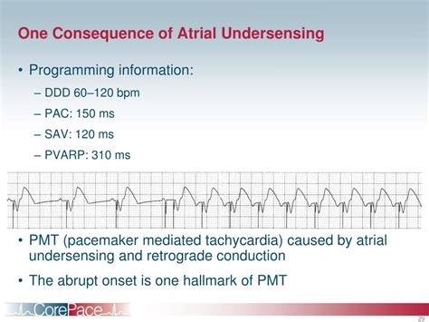Ppt Pacemaker Troubleshooting Module 9 Powerpoint Presentation Free