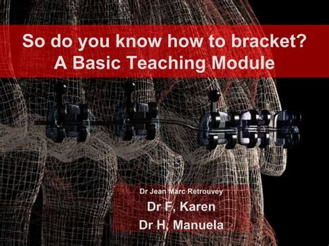Direct Bracketing Technique For Dental Professionals Ppt