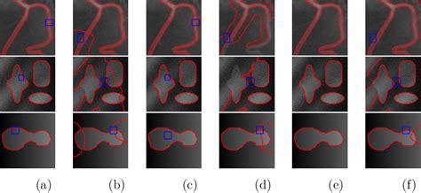 Figure 42 From Two Phase Segmentation For Intensity Inhomogeneous Images By The Allen Cahn