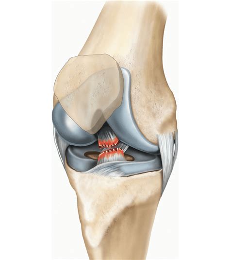 Ligament Injury Anterior Cruciate Ligament Injury Physio Check