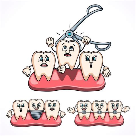Tooth Extraction Surgery Vector Art Icons And Graphics For Free Download