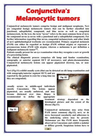 Melanocytes Tumors 2018 Pdf