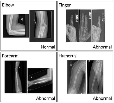 Ktbyte Brings Real Life Applications To Machine Learning Course