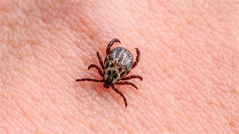 Lyme Disease Gpnotebook
